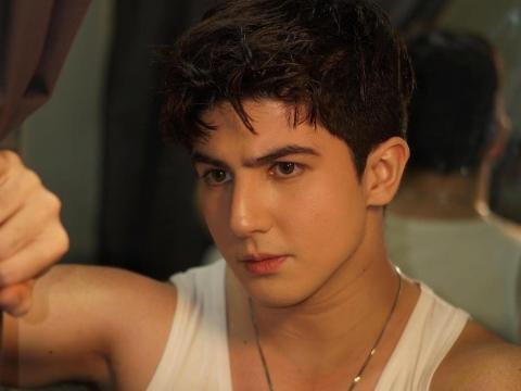Mavy Legaspi Braces
