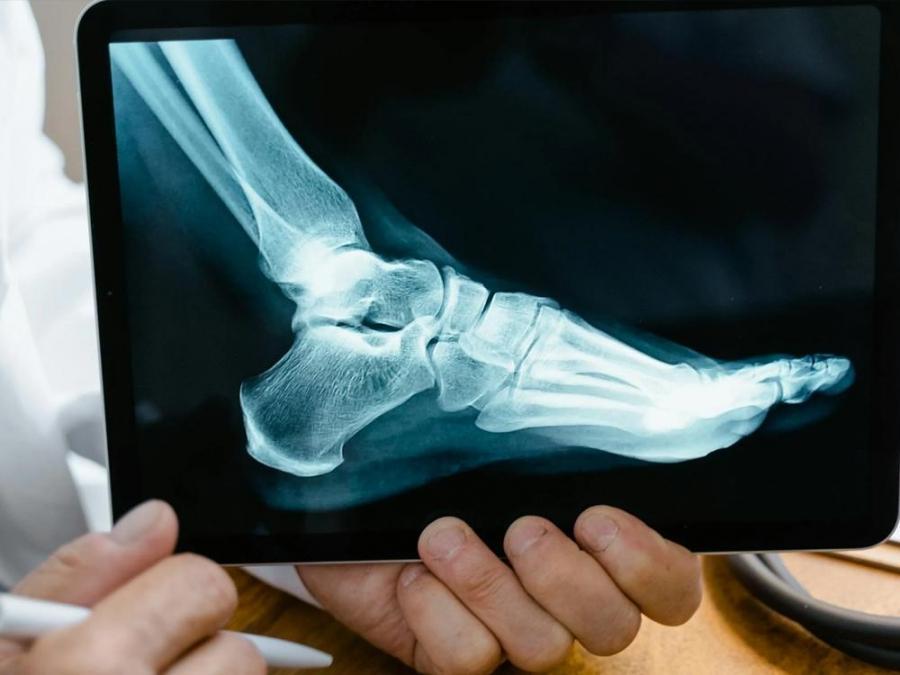 What does having 'green bones' mean?