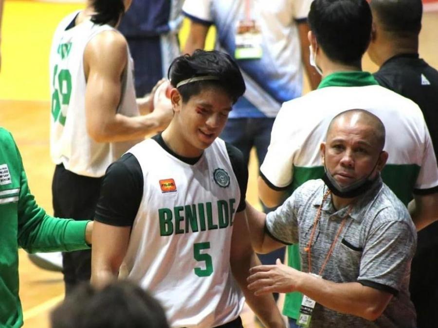 'Daddy's Gurl' star Prince Carlos suffers injury during Filoil EcoOil ...