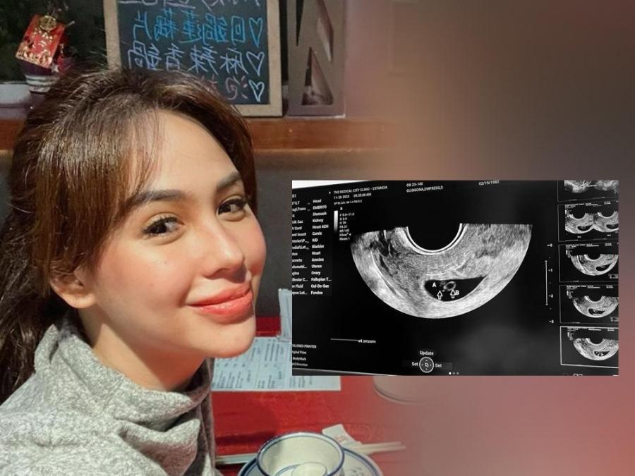 Empress Schuck receives comfort from friends after miscarriage | GMA Entertainment