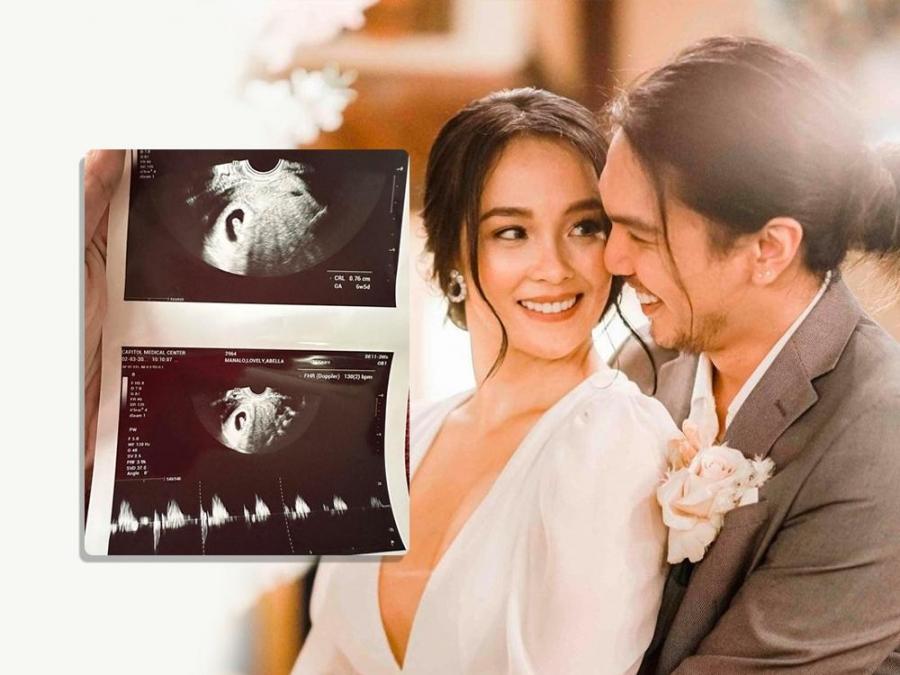 Lovely Abella, sobrang tuwa nang marinig ang heartbeat ng kanilang 'miracle baby' | GMA ...