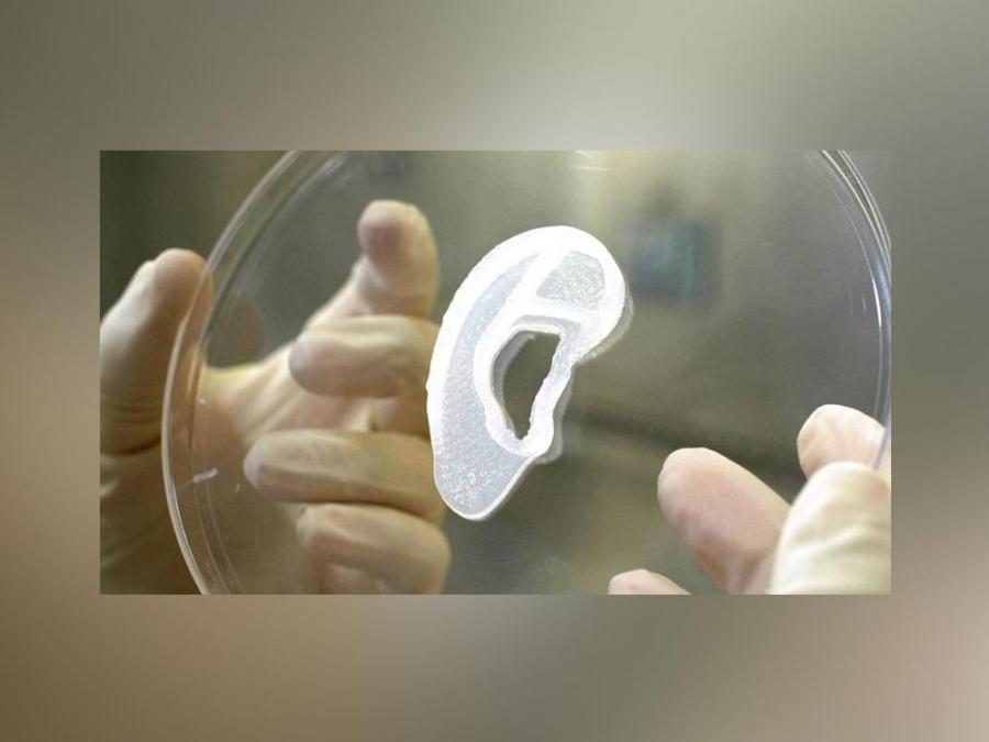 Surgeons transplant 3D ear made of living cells