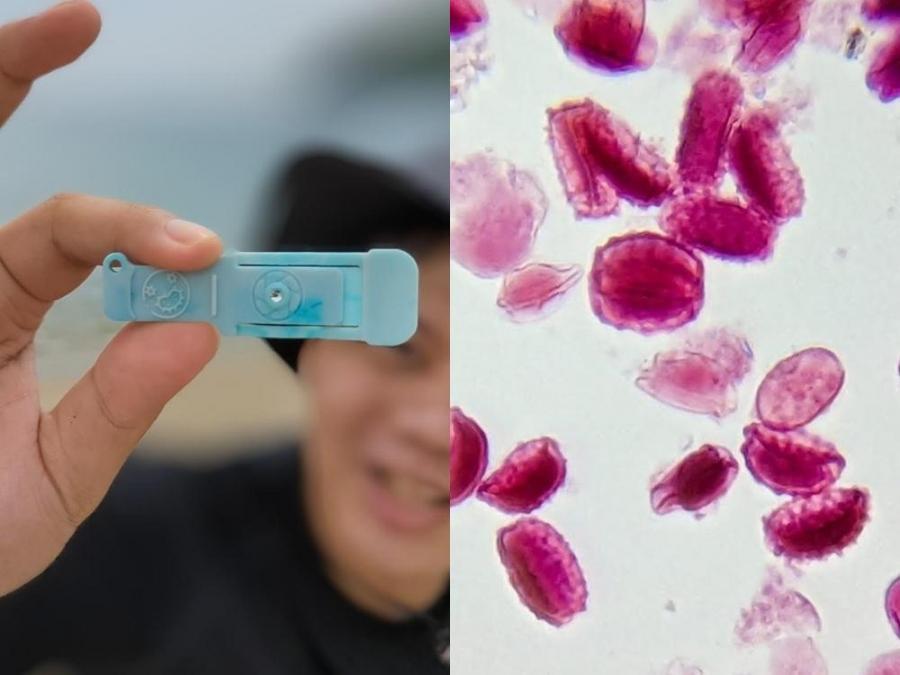 Keychain-sized microscope invented by a Pinoy wins Dyson Award
