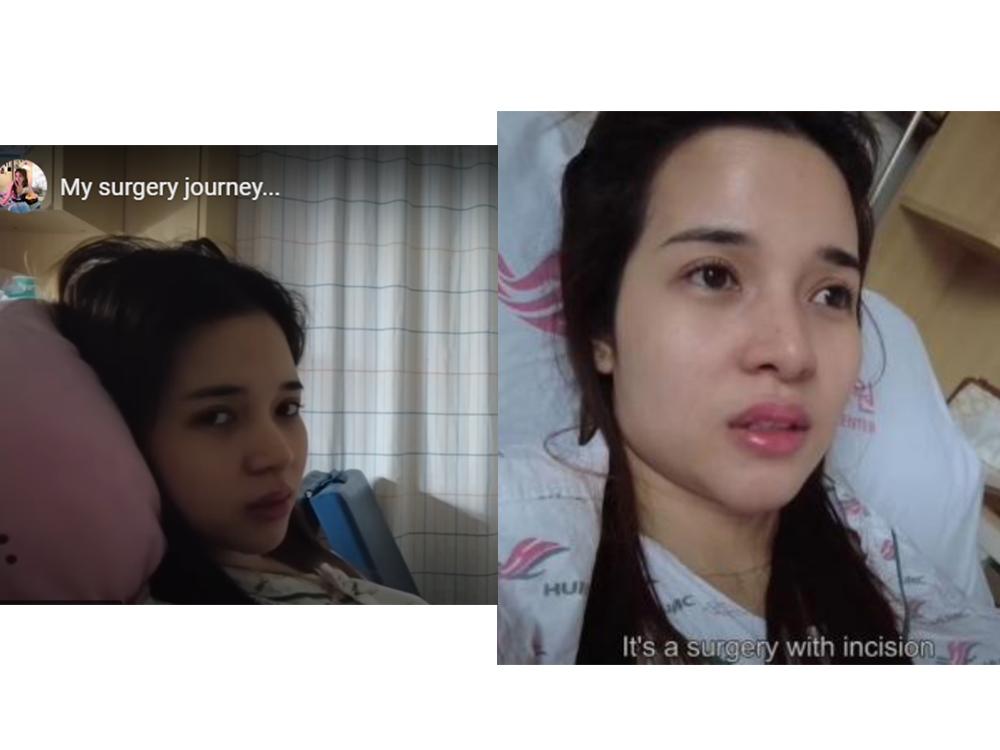 Content creator Jico Umali now recovering after suffering from stroke: 'I almost died' | GMA ...