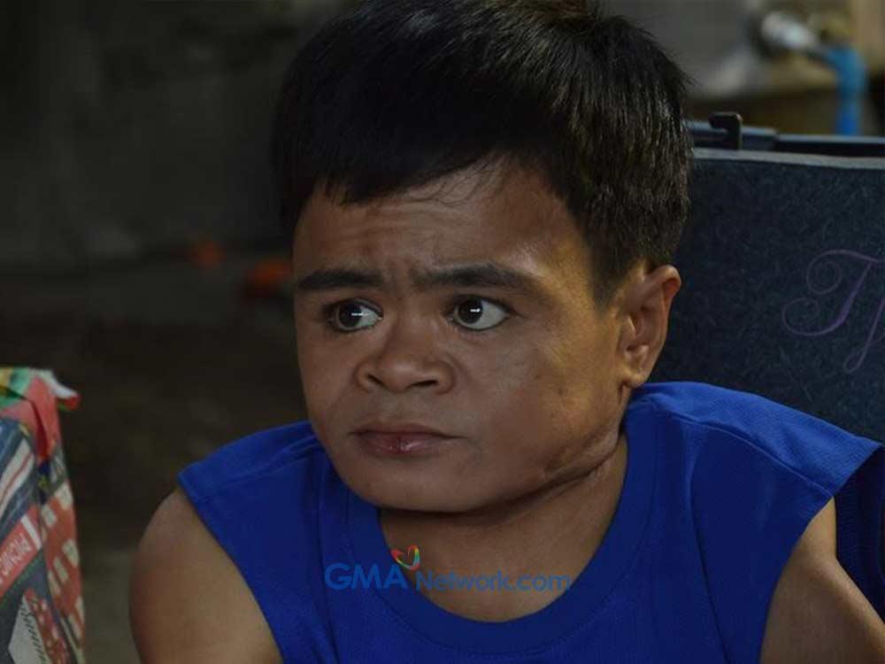 IN PHOTOS: Kilalanin si Erwin Dayrit at ang kanyang kakaibang kondisyon ...