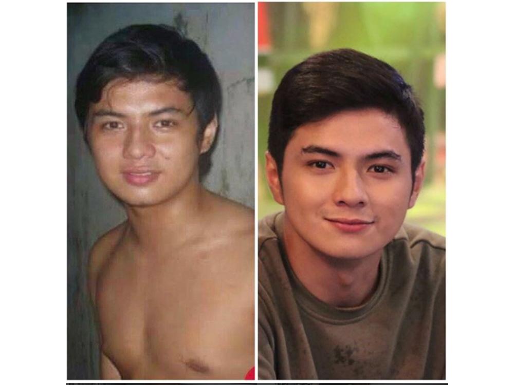 LOOK: How much did these celebrities change from 2012-2017? | GMA ...