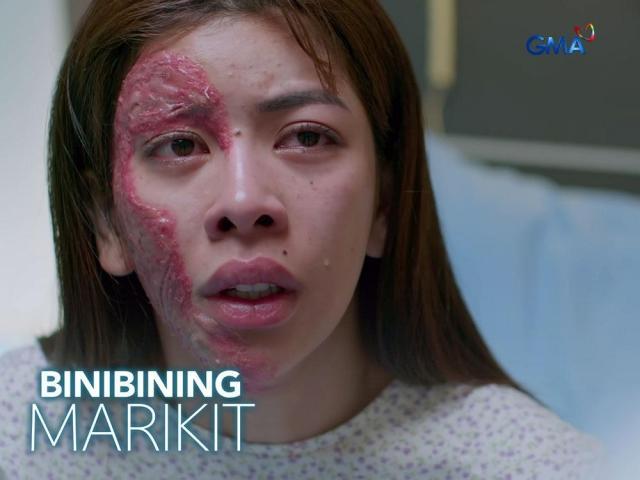 Binibining Marikit: Ikit's face is extremely damaged by the fire ...