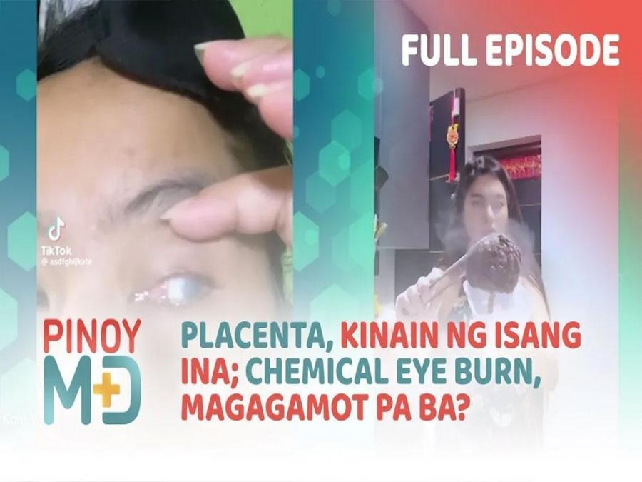 Placenta, kinain ng isang ina; Chemical eye burn, magagamot pa ba ...