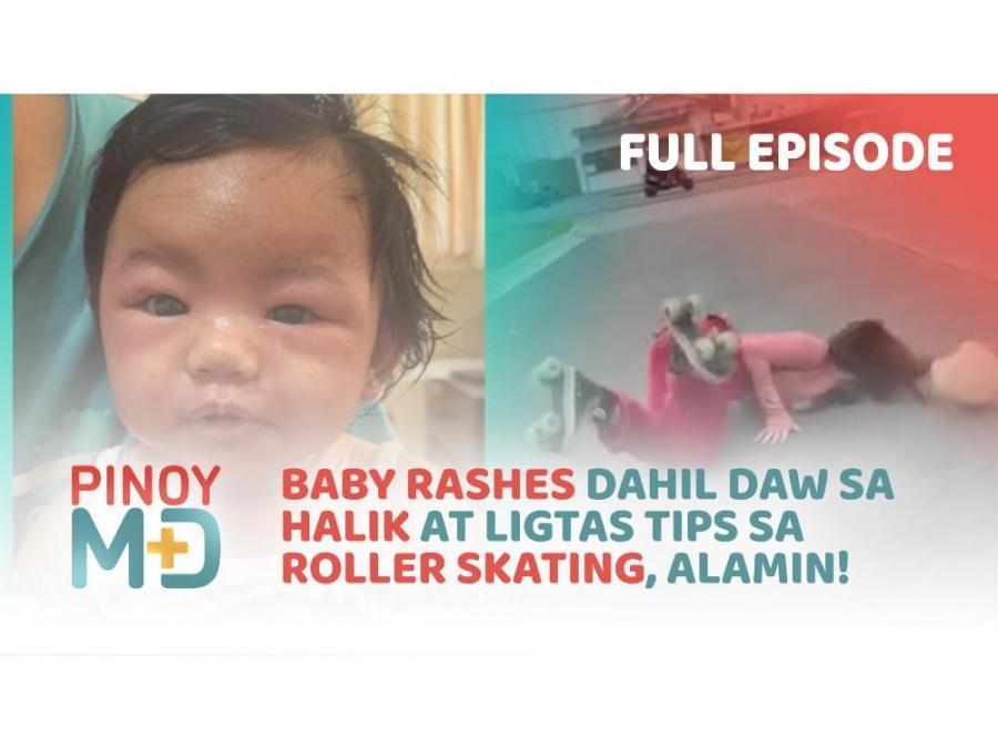 Baby rashes dahil daw sa halik at ligtas tips sa roller skating, alamin ...