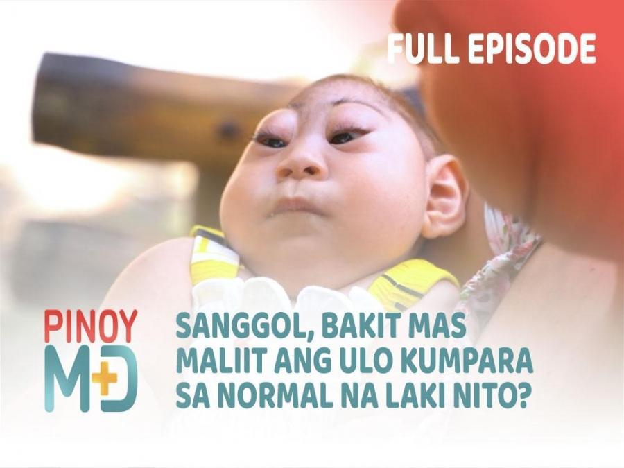 Sanggol, bakit mas maliit ang ulo kumpara sa normal na laki nito? (Full Episode) | Pinoy MD ...