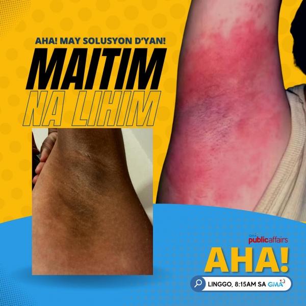 Maitim na kili-kili ng isang babae at kabaong unboxing ng isang vlogger, iimbestigahan sa 'AHA ...